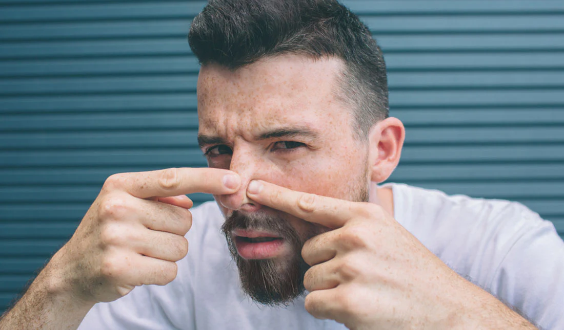How To Get Rid Of Nose Blackheads In Men Macho Vibes