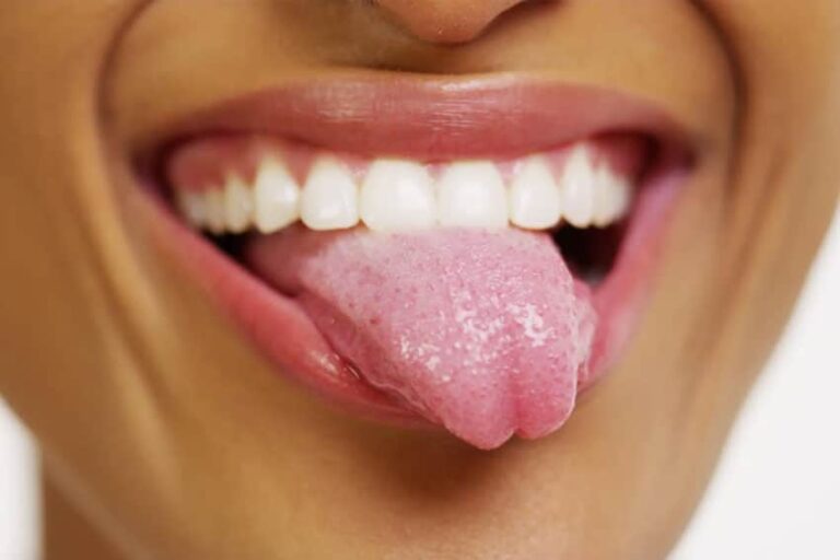 What Questions to Ask If You Have A Scalloped Tongue – Macho Vibes