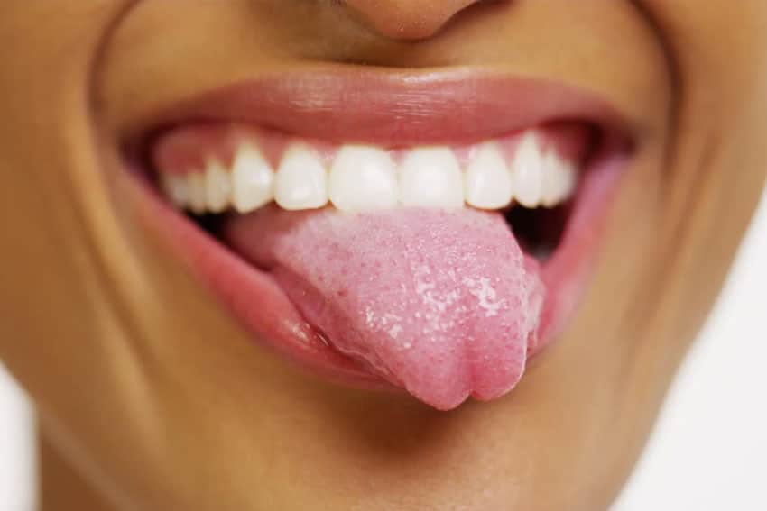 What Questions to Ask If You Have A Scalloped Tongue – Macho Vibes